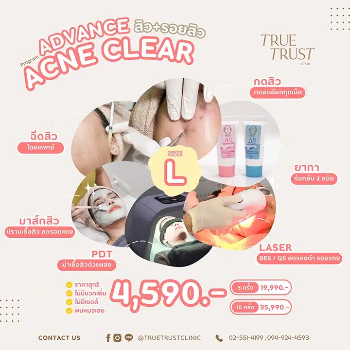 รักษาสิว - TrueTrust Clinic